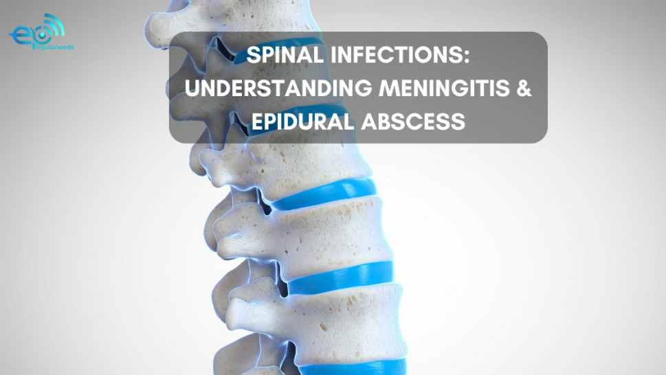 Spinal Infections: Understanding Meningitis & Epidural Abscess ...
