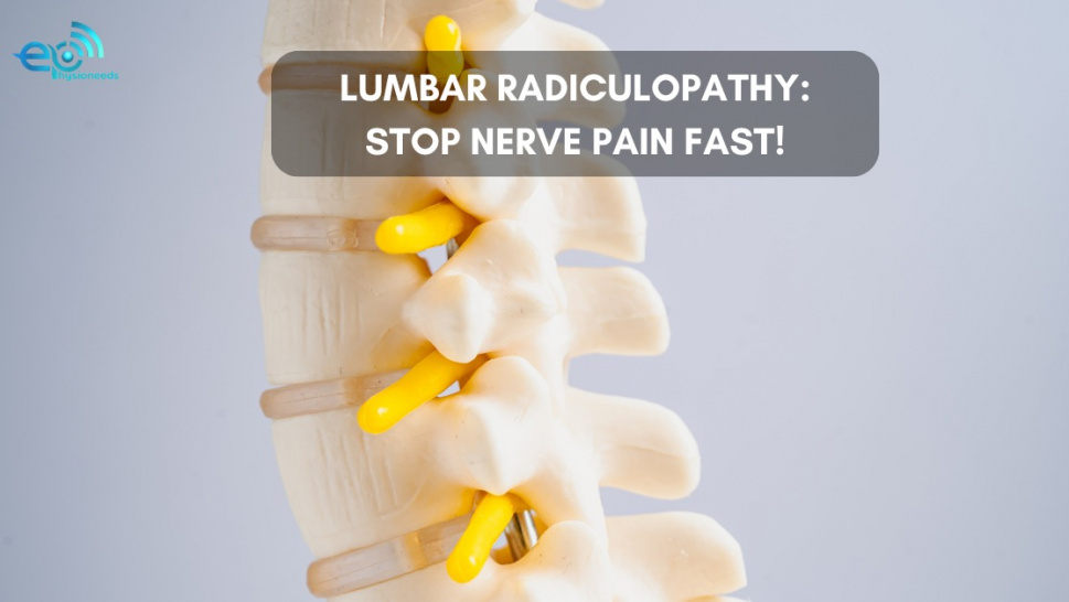 Lumbar Radiculopathy: Stop Nerve Pain Fast! - Lopinion - GLBrain.com