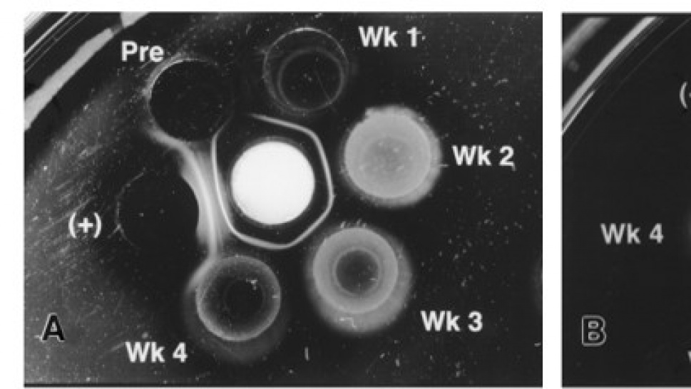 CREATIVE DIAGNOSTICS ANNOUNCES NOVEL AGAR GEL PRECIPITIN TESTS FOR ...